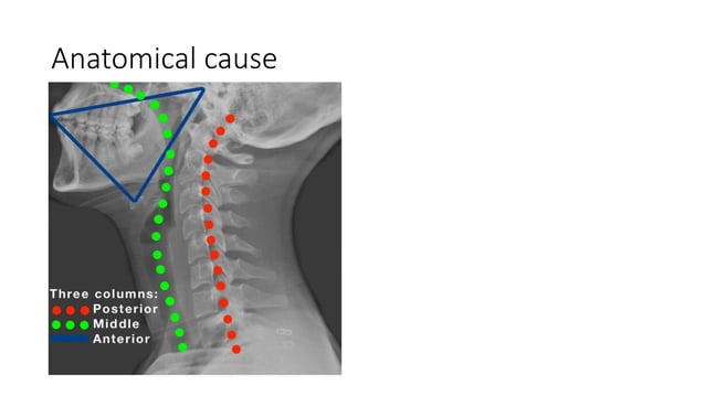 Difficult Airway.pptx