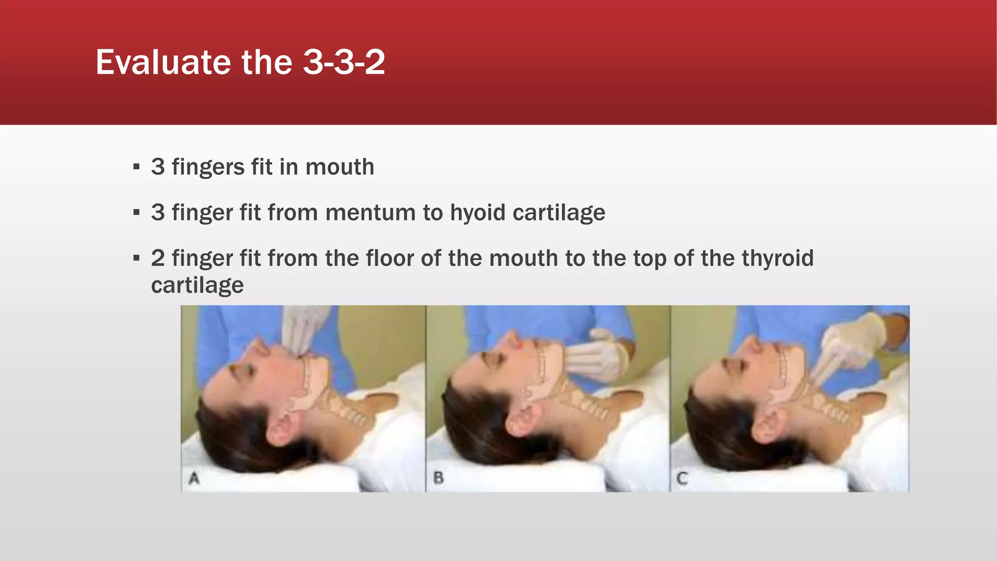 Difficult airway assessment and management by sardar saud abbas | PPTX