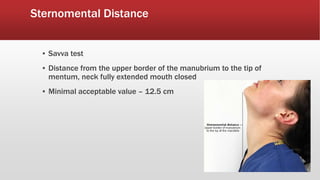 Difficult airway assessment and management by sardar saud abbas | PPTX