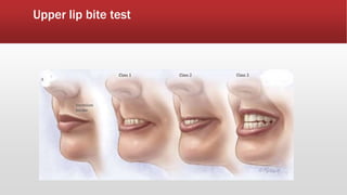 Difficult airway assessment and management by sardar saud abbas | PPTX