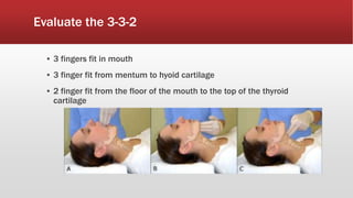 Difficult airway assessment and management by sardar saud abbas | PPTX
