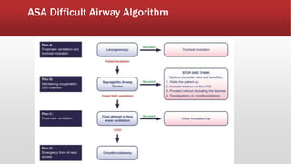 Difficult airway assessment and management by sardar saud abbas | PPTX