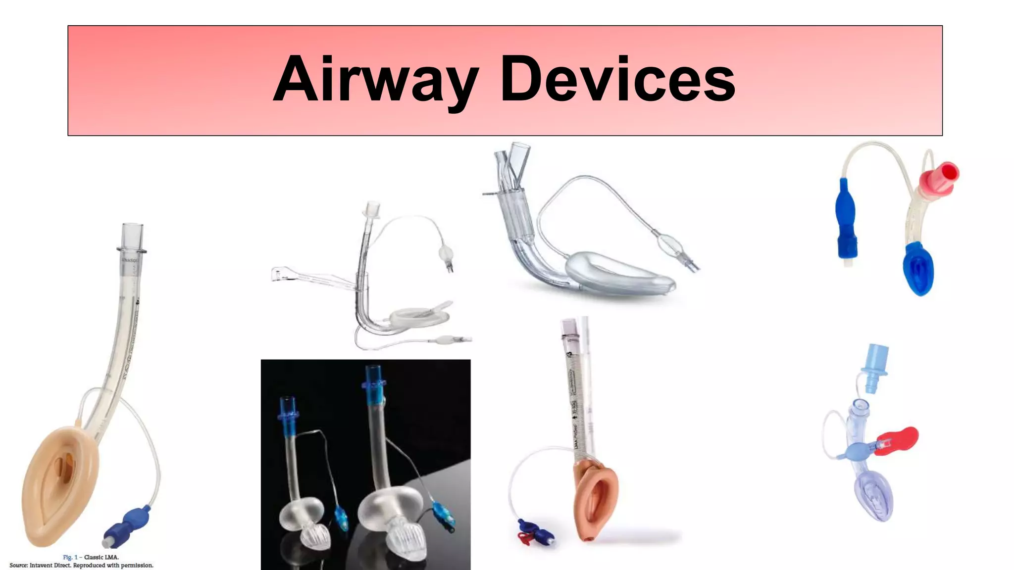 Difficult airway guidelines paeds | PPTX