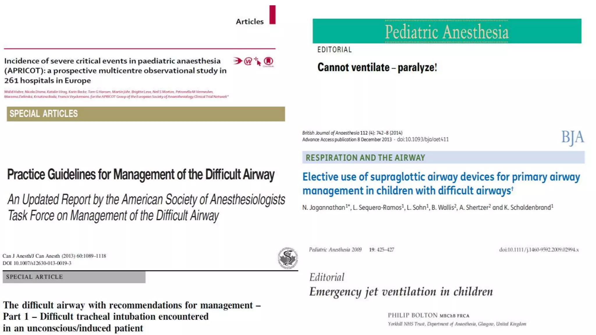 Difficult Airway Guidelines Paeds Ppt
