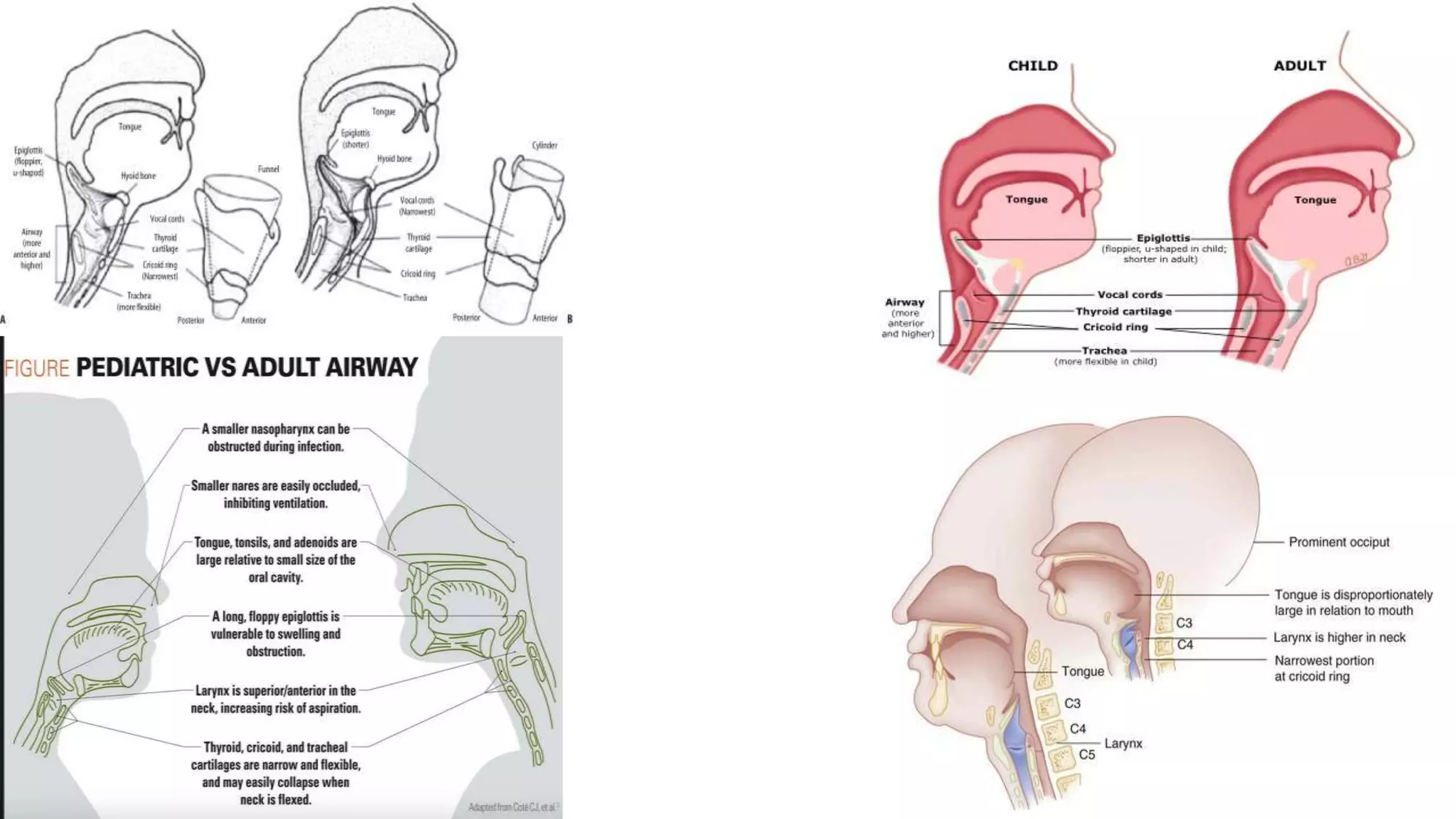 Difficult Airway Guidelines Paeds Pptx