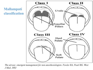 Difficult airway in ICU by Dr. Aditya Jindal | JIndal Chest Clinic | PPTX