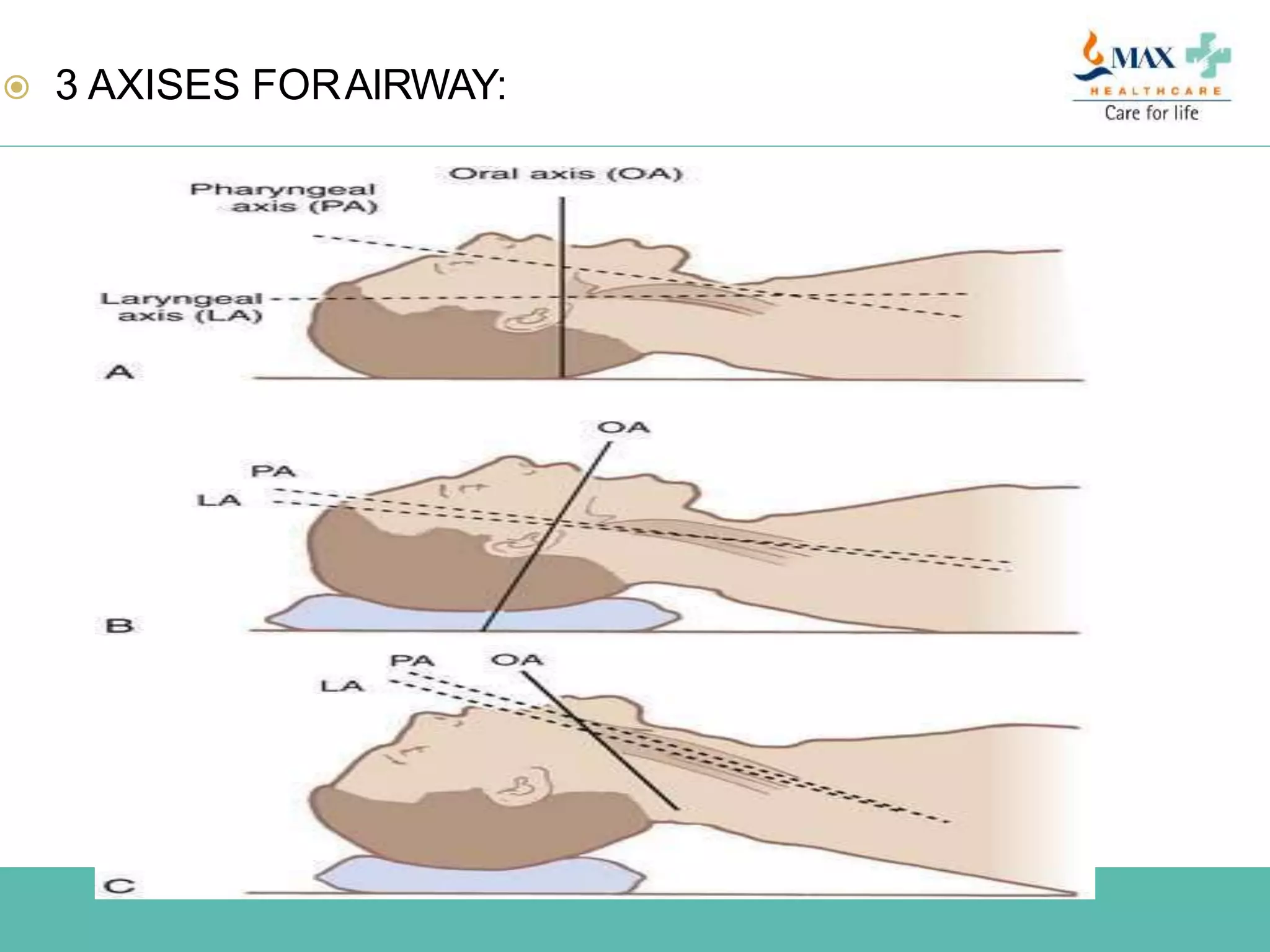 Difficult airway management in ICU | PPTX