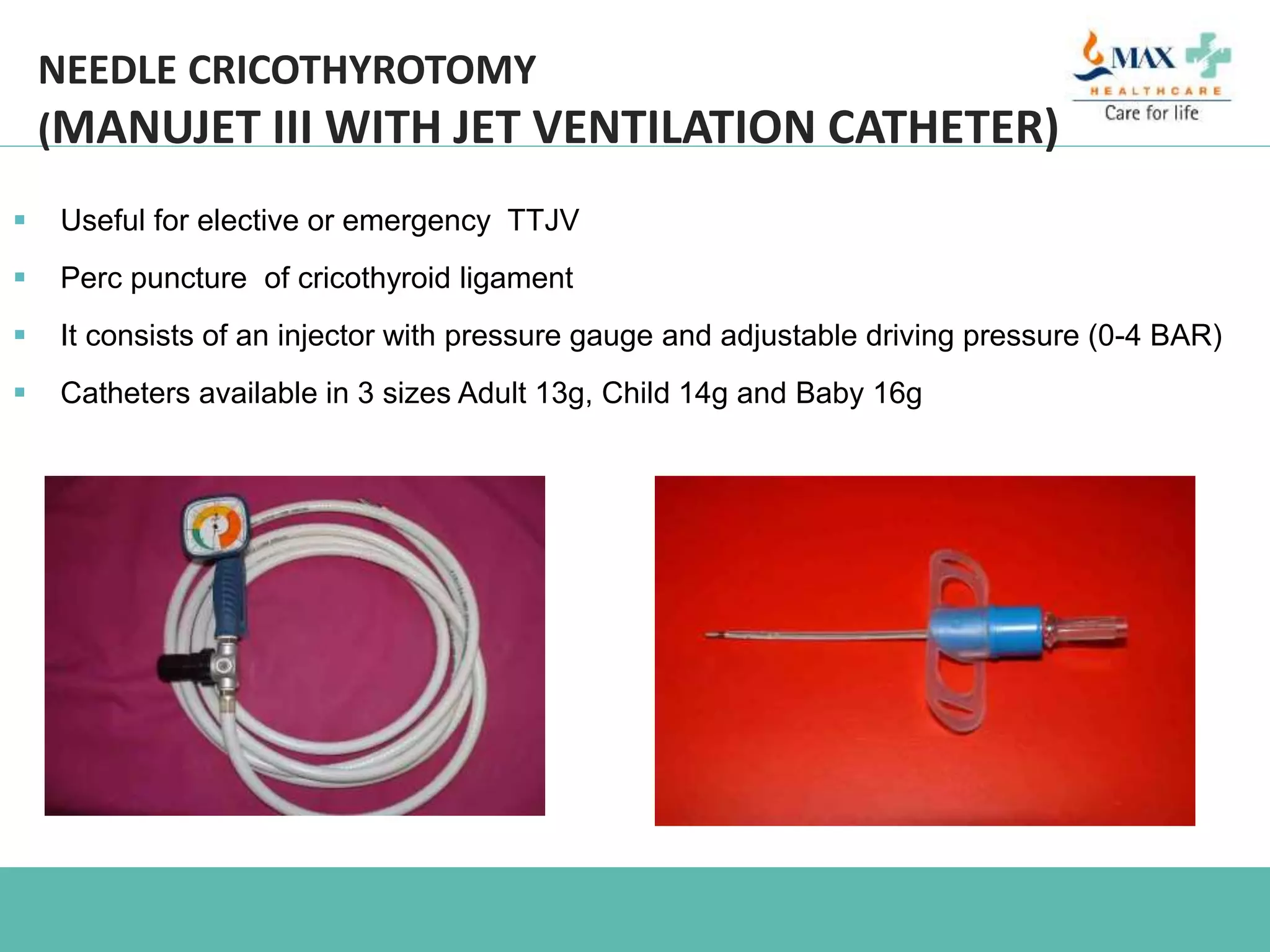 Difficult airway management in ICU | PPTX