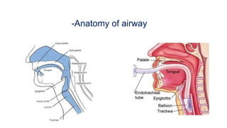 Difficult airway management | PPTX