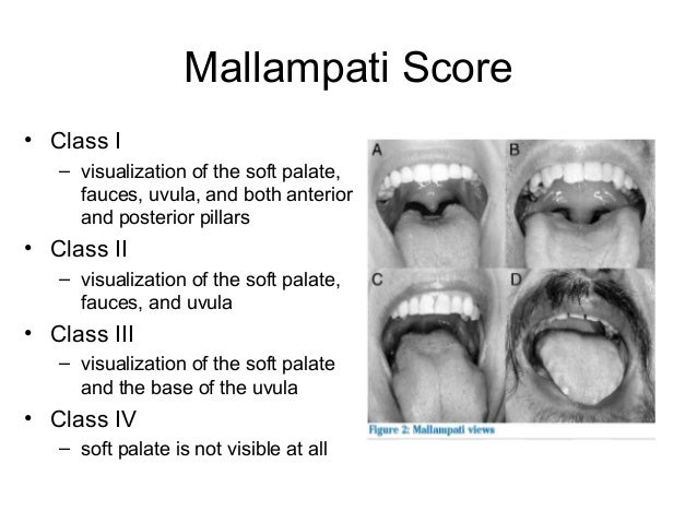Difficult airway managemnt