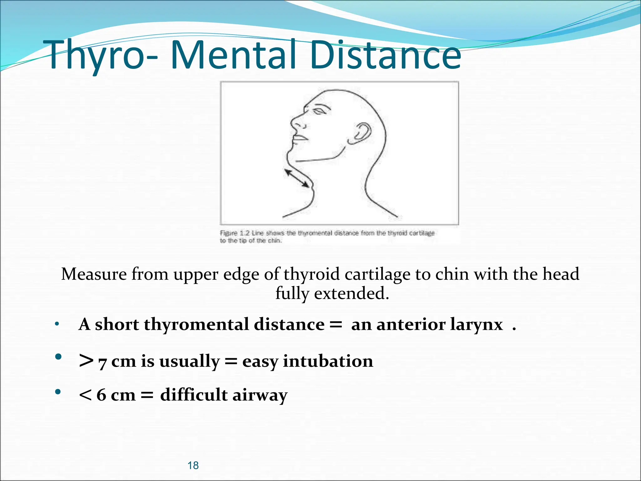 difficult airway managment indication and methed.ppt