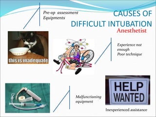 difficult airway managment indication and methed.ppt