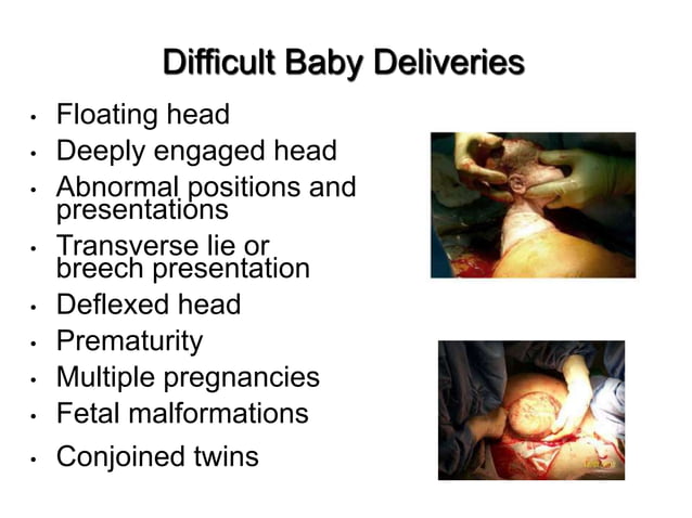 Difficult c section | PPTX