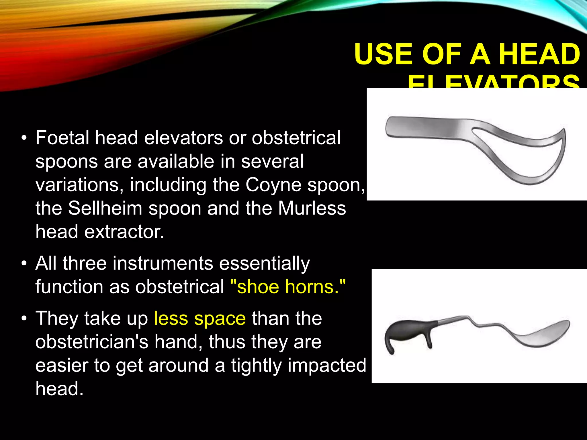 Difficult extraction of the fetus presented in aicog 09.01.19
