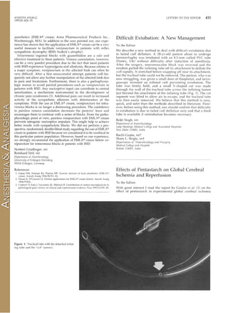 Difficult extubation a new management | PDF