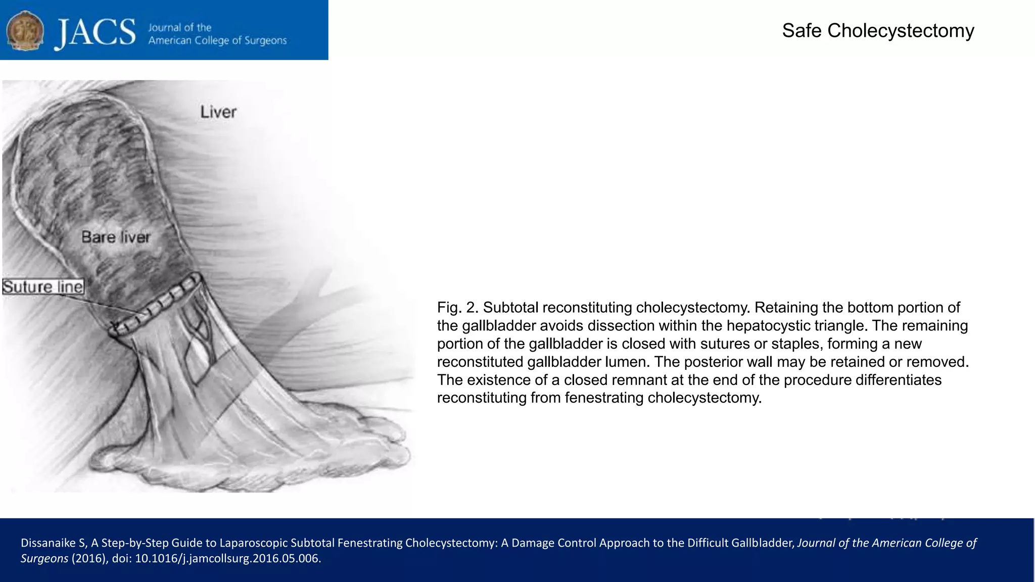Difficult Gallbladder.pptx