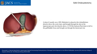 Difficult Gallbladder.pptx