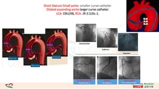 Difficulties in Trans Radial PCI. | PPTX
