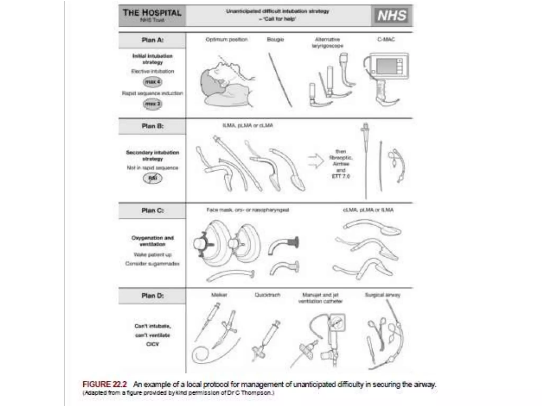 DIFFICULT__INTUBATION.pptx