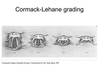 DIFFICULT__INTUBATION.pptx