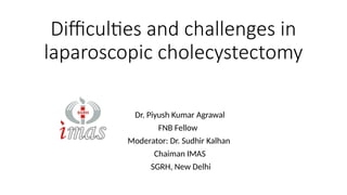 Difficult Laparoscopic cholecystectomy The Clinnic.pptx