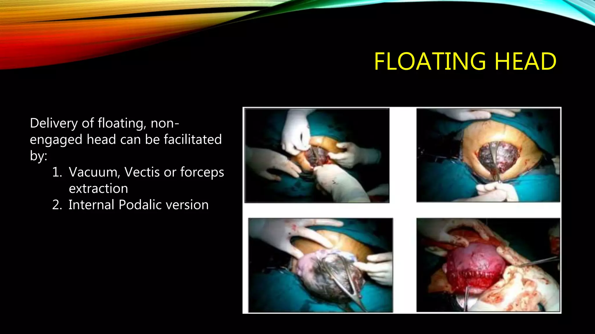 Difficult lscs | PPTX
