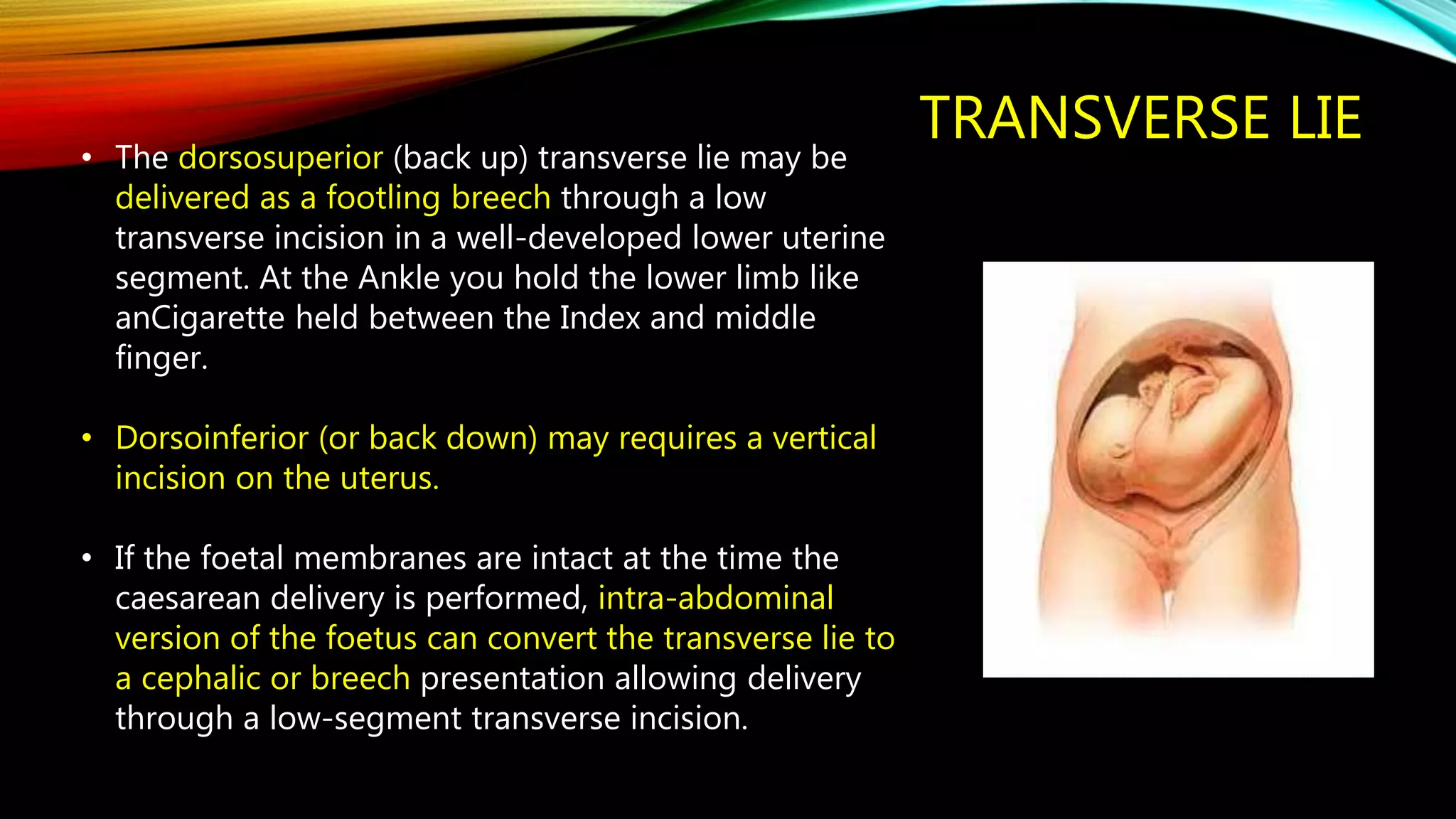 Difficult lscs | PPTX