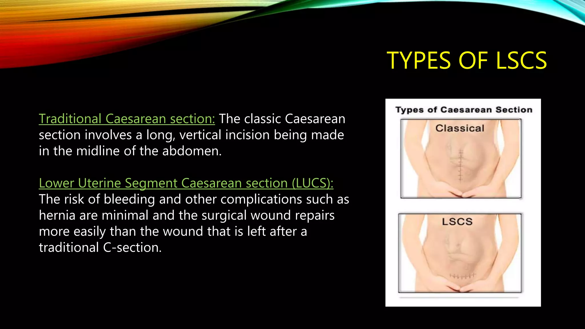 Difficult lscs | PPTX