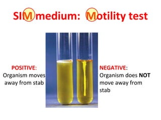 Sim Test Motility