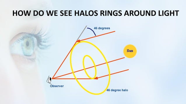 Diffraction in glaucomatic eye | PPT