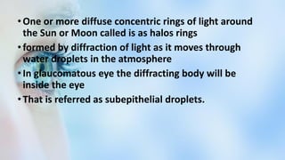 Diffraction in glaucomatic eye | PPT
