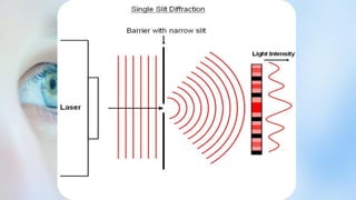Diffraction in glaucomatic eye | PPT