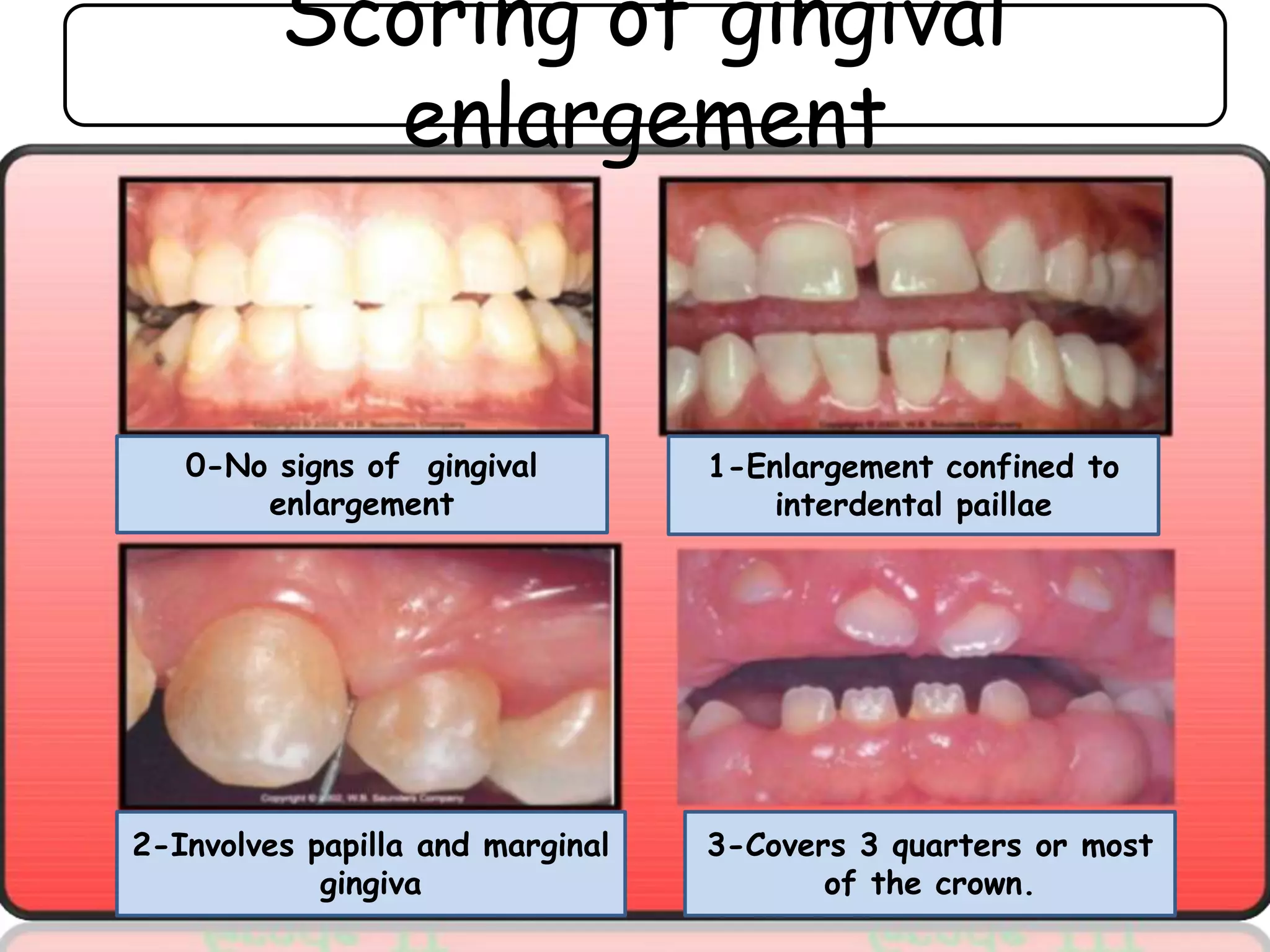 Diffrential diagnosis of common teeth complaints | PPTX