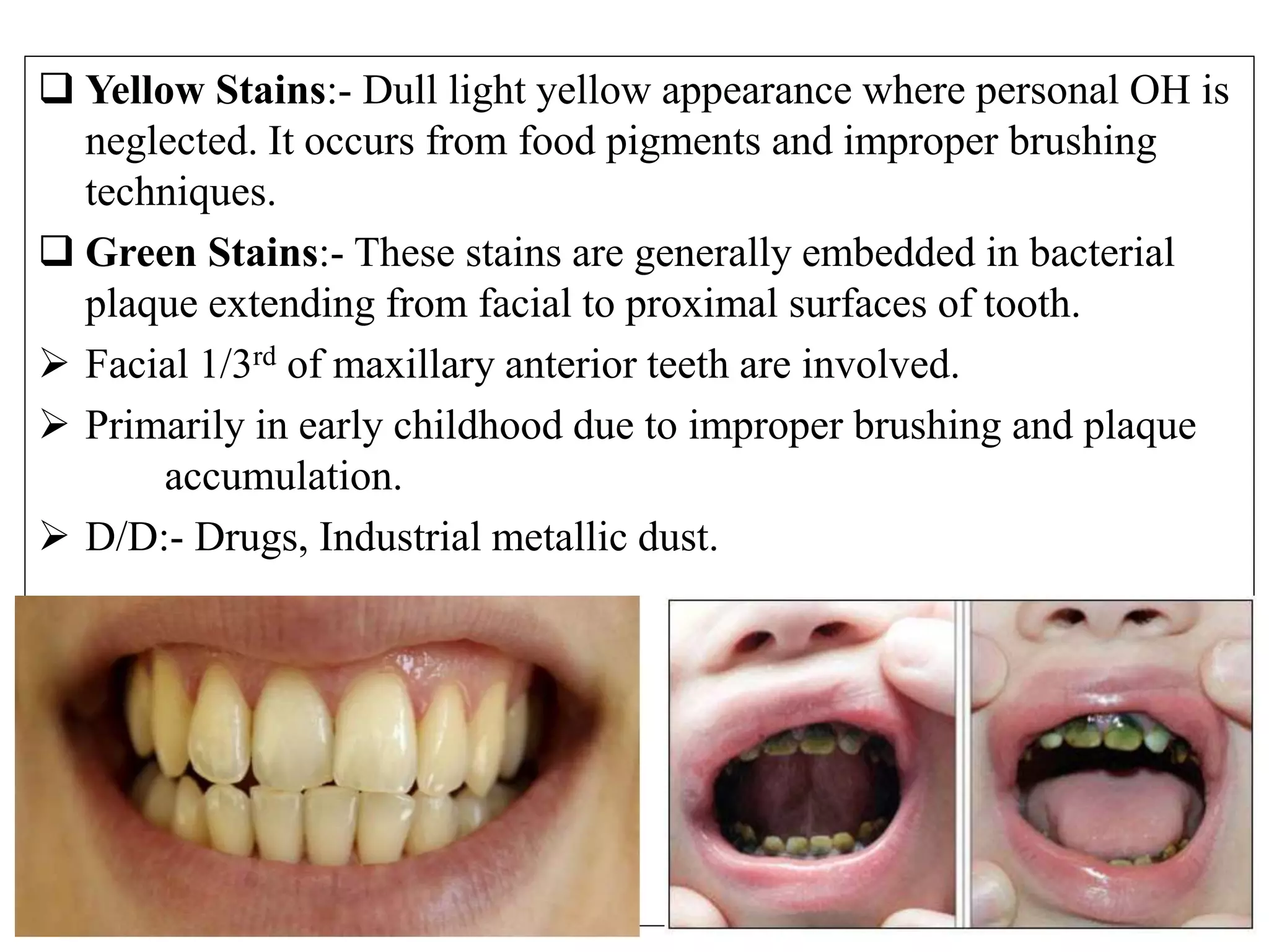 Diffrential diagnosis of common teeth complaints | PPTX
