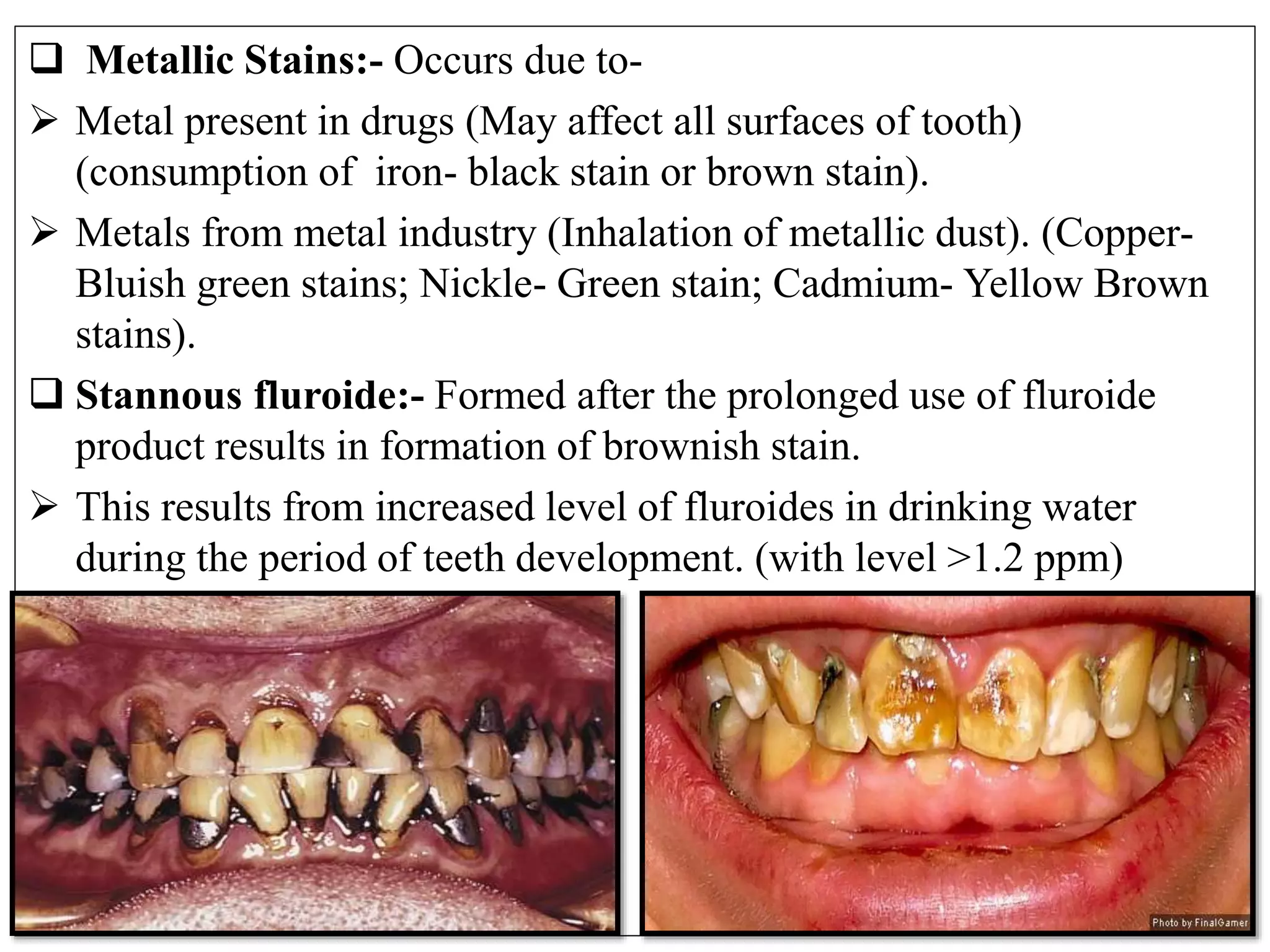 Diffrential diagnosis of common teeth complaints | PPTX