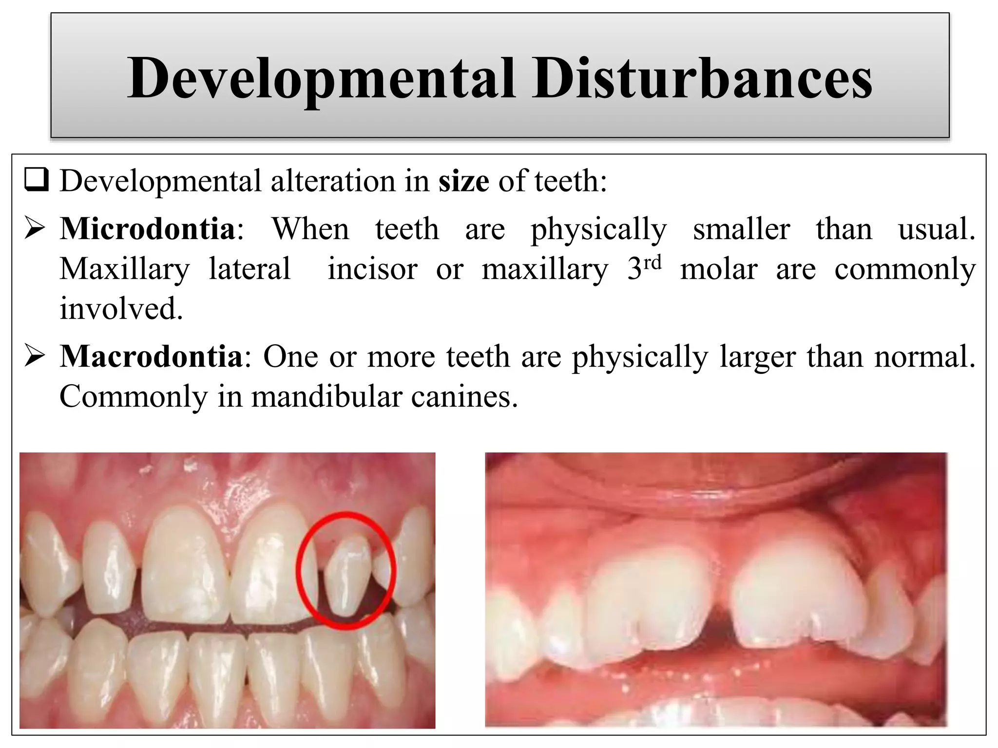 Diffrential diagnosis of common teeth complaints | PPTX