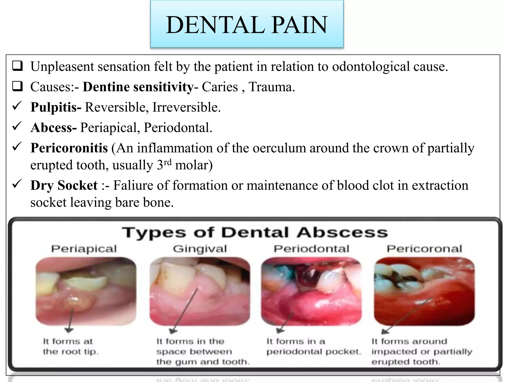 Diffrential diagnosis of common teeth complaints | PPTX
