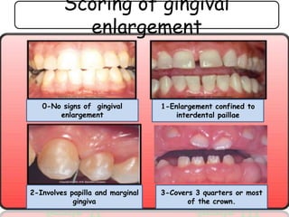 Diffrential diagnosis of common teeth complaints | PPTX