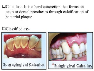 Diffrential diagnosis of common teeth complaints | PPTX