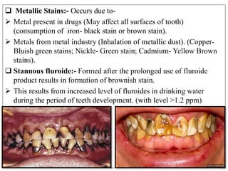 Diffrential diagnosis of common teeth complaints | PPTX