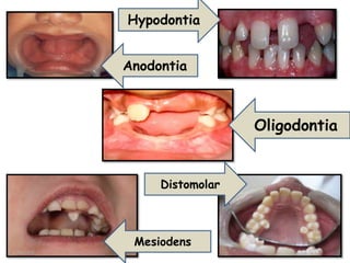Diffrential diagnosis of common teeth complaints | PPTX