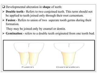 Diffrential diagnosis of common teeth complaints | PPTX