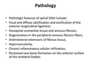 Diffuse idiopathic skeletal hyperostosis | PPTX