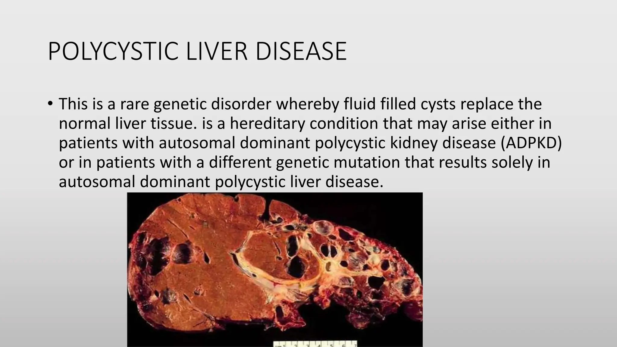 DIFFUSE LIVER DISEASES AND THEIR APPEARANCE IN ULTRASOUND | PPTX