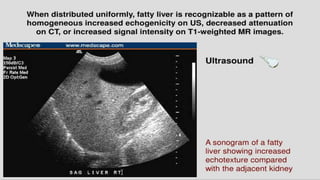 DIFFUSE LIVER DISEASES AND THEIR APPEARANCE IN ULTRASOUND | PPTX