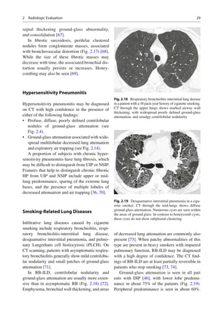 Diffuse lung disease | PDF