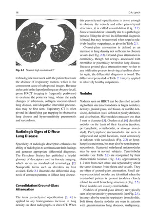 Diffuse lung disease | PDF