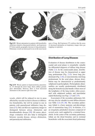 Diffuse lung disease | PDF