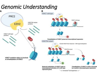 Diffuse Midline Gliomas/ Diffuse Pontine Gliomas.pptx