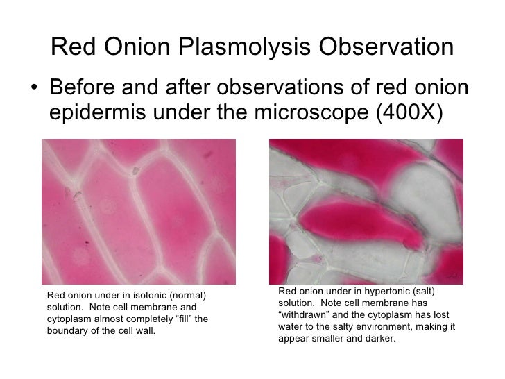 Red Onion Cell Mounted In Salt Solution Histology Lab Name: Amber